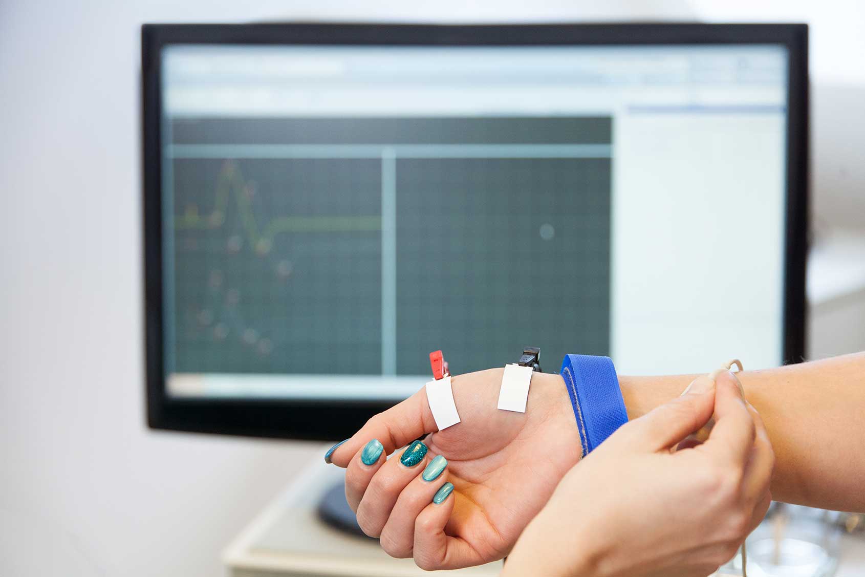 Elektroneurographie - Neurologie Bodenheim